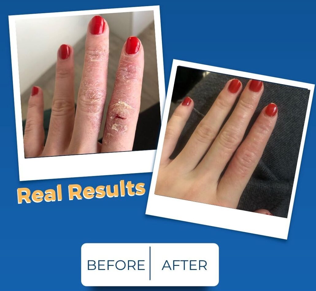 Healing Hands: Gloves In A Bottle Shielding Lotion for Dry Hands